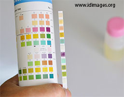 Infectious Disease Images - eMicrobes Digital Library - Cases