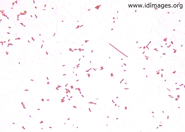 Infectious Disease Images - eMicrobes Digital Library - Images